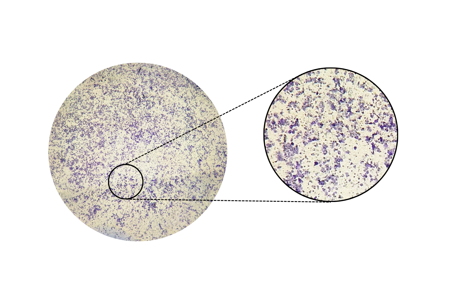 Transwell Migration and Invasion Assay – the complete breakdown - SnapCyte Transwell Migration and Invasion Assay – the complete breakdown - SnapCyte